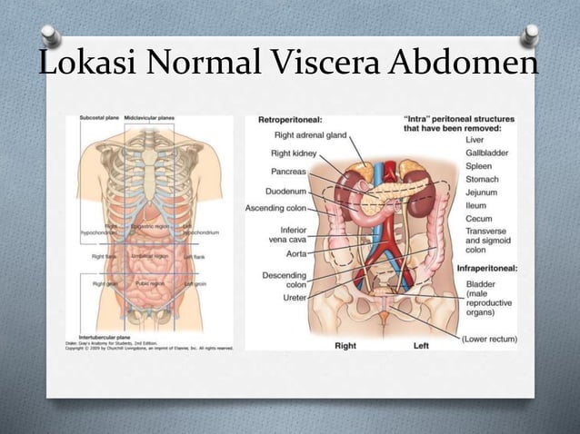 Acute Abdomen (acute abdominal pain).pptx
