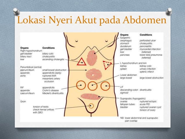 Acute Abdomen (acute abdominal pain).pptx
