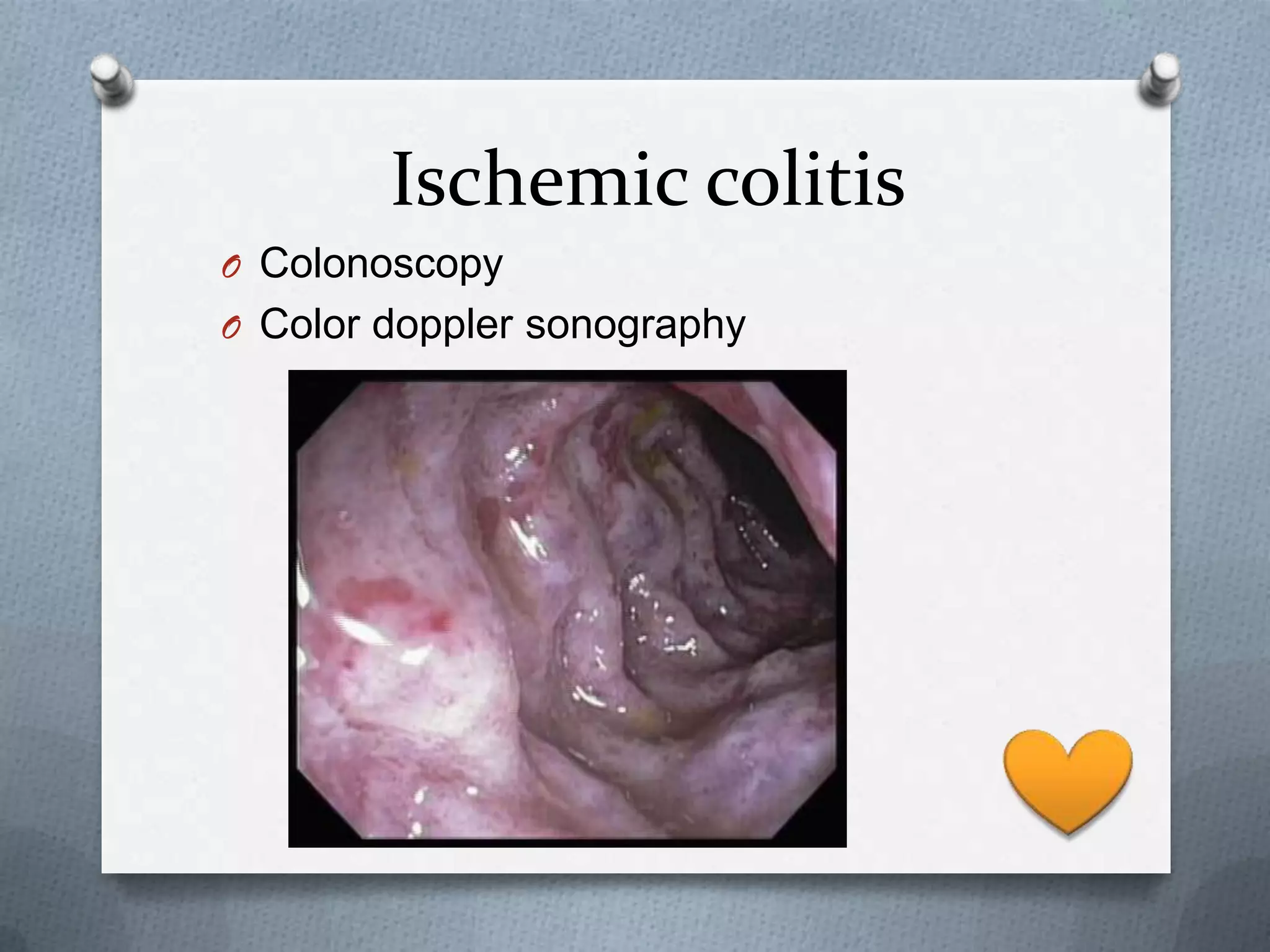 Acute Abdominal Pain | PPTX