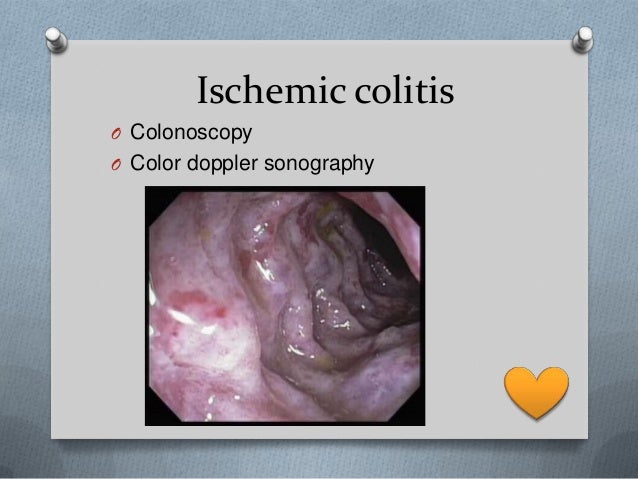 Acute Abdominal Pain