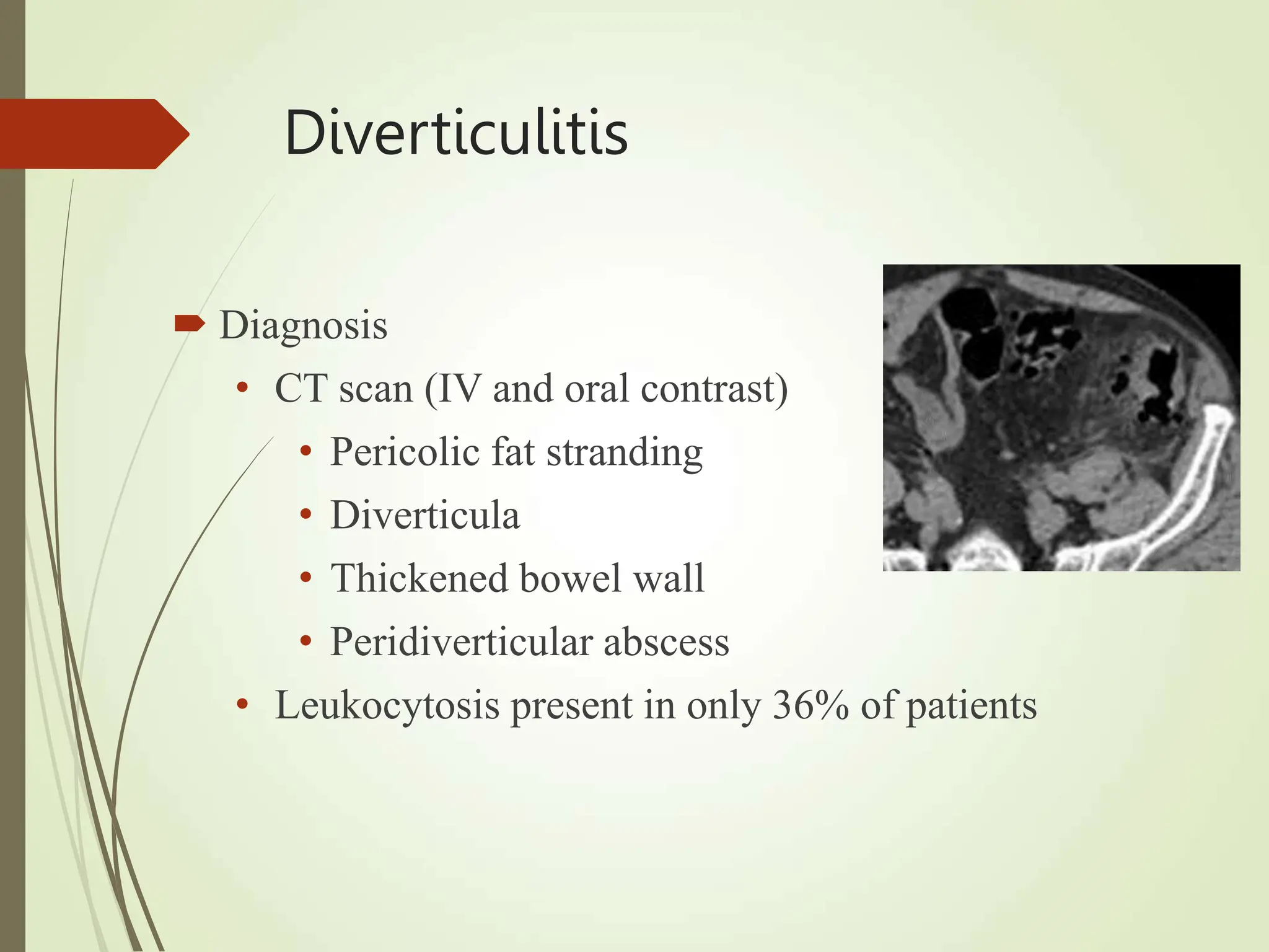 Acute Abdominal Pain MS-General surgery lecture.ppt