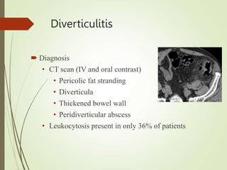 Acute Abdominal Pain MS-General surgery lecture.ppt