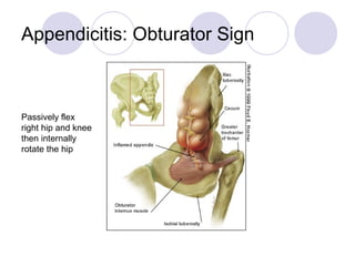 Acute abdominal pain ms lecture ppt | PPT