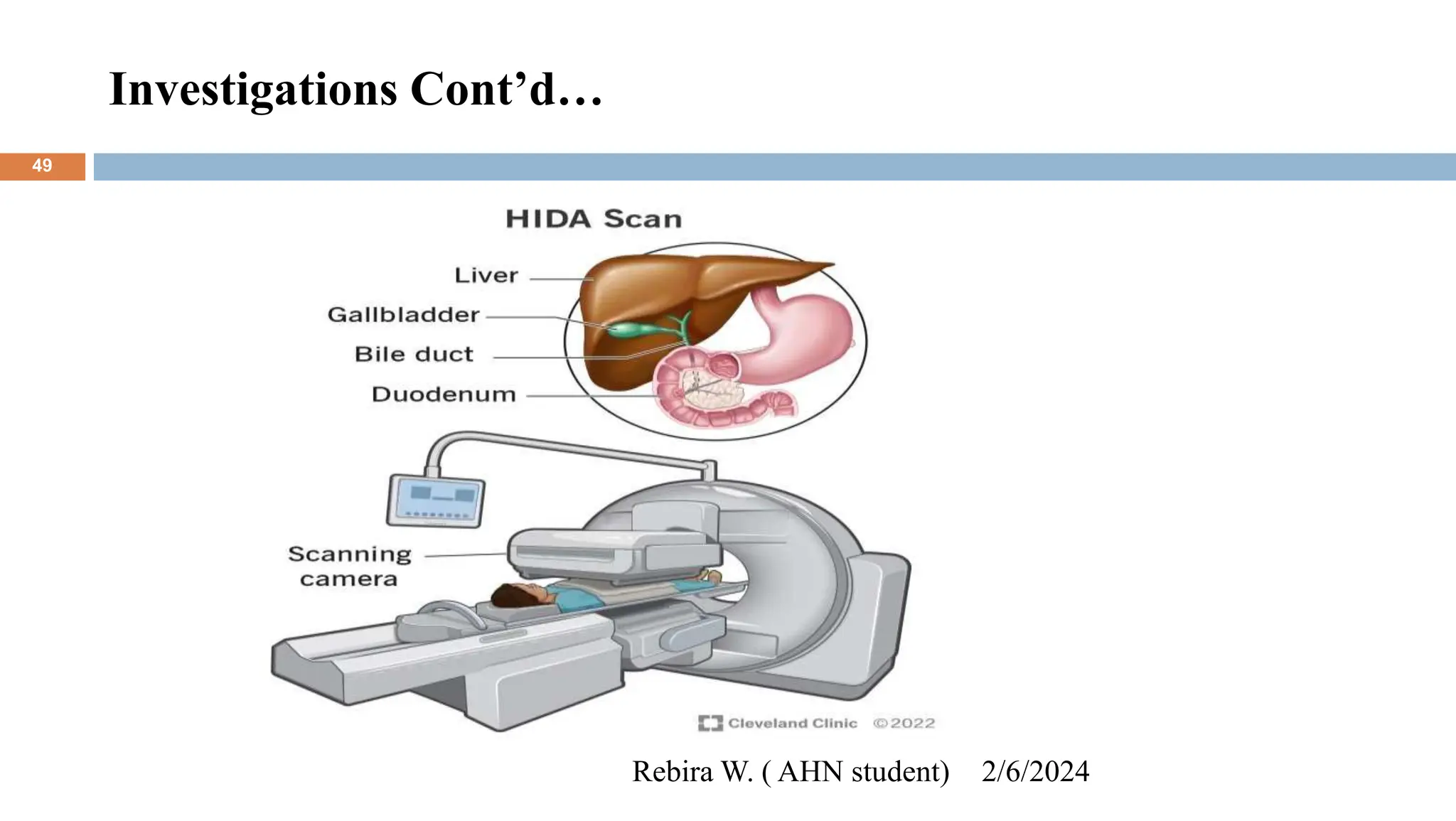 Acute Acalculous Cholecystitis Seminar Presentation.pptx