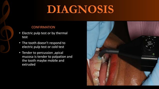 Acute alveolar abscess | PPTX