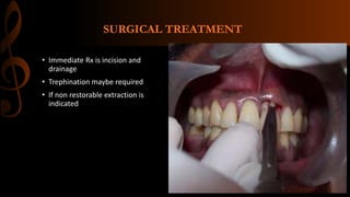 Acute alveolar abscess | PPTX