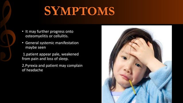 Acute alveolar abscess | PPTX