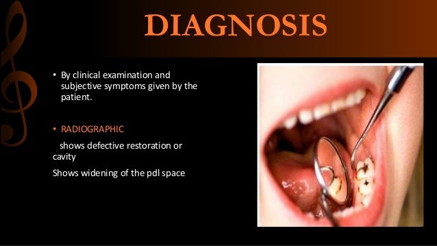 Acute alveolar abscess
