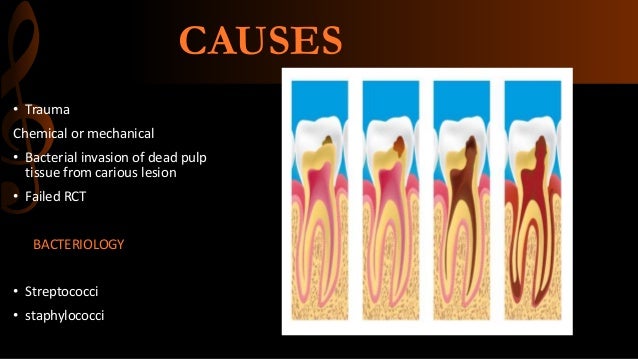 Acute alveolar abscess
