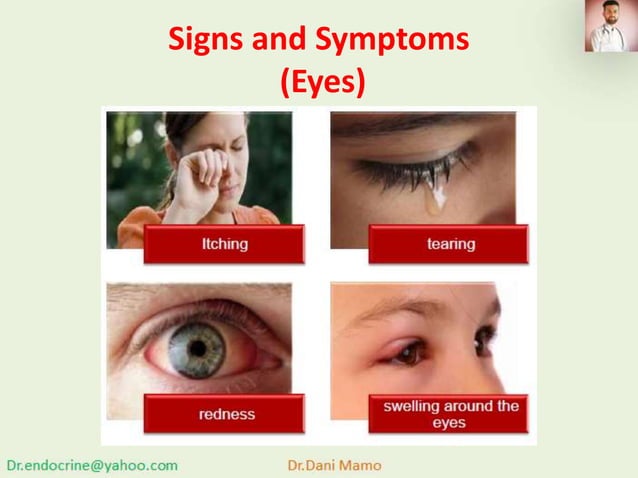 Acute anaphylaxis and anaphylactic reactions | PPTX | First Aid | Injuries