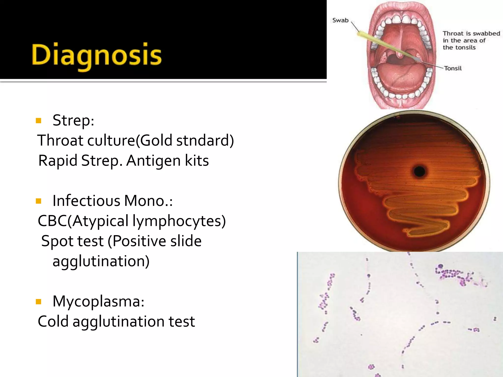 ACUTE AND CHRONIC CONDITION OF PHARYNX & LARYNX.ppt
