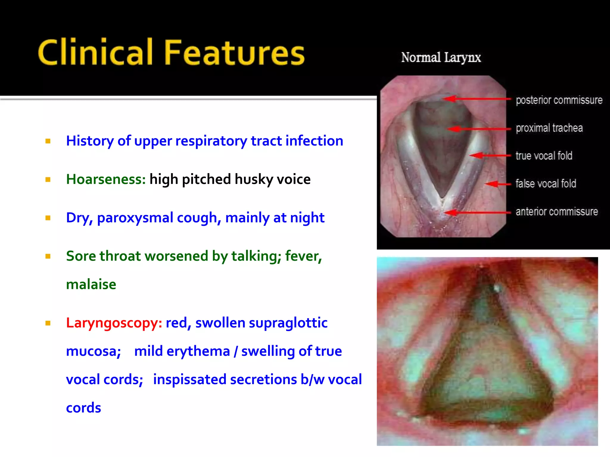 ACUTE AND CHRONIC CONDITION OF PHARYNX & LARYNX.ppt