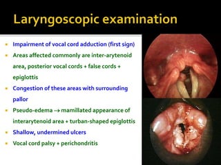 ACUTE AND CHRONIC CONDITION OF PHARYNX & LARYNX.ppt