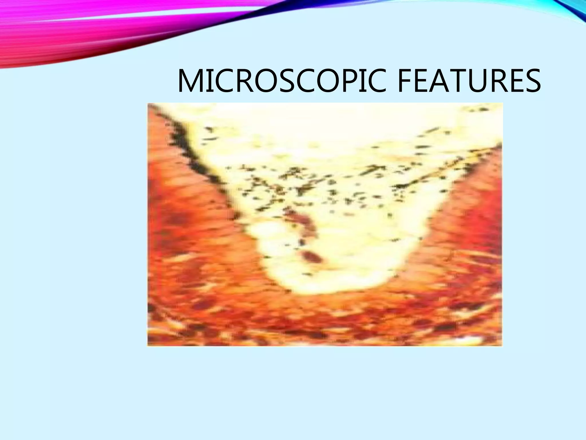 Acute and Chronic gastritis | PPTX
