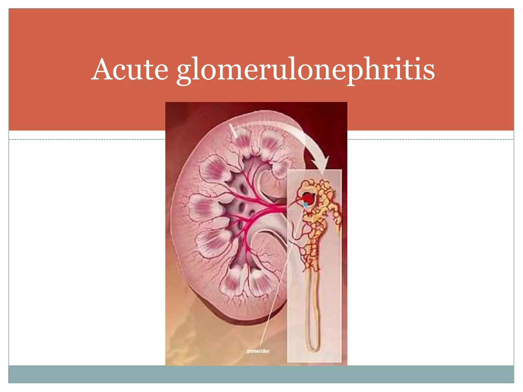 Acute and chronic glomerulonephritis | PPT