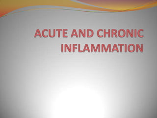 Acute and chronic inflammation 1 robbins | PPTX
