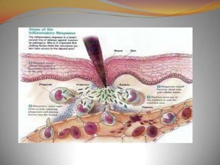 Acute and chronic inflammation 1 robbins | PPTX