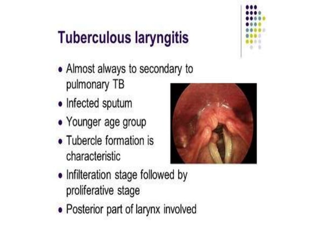 Acute and chronic inflammations of larynx | PPT | Free Download