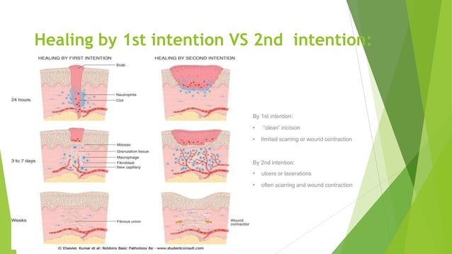 Acute and Chronic inflammation & Wound Healing | PPTX | Blood Disorders ...