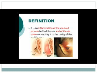 Acute and Chronic Mastoiditis. serious health problem | PPTX
