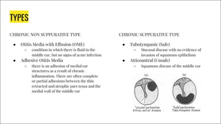 Case discussion on Acute and Chronic Otitis Media.pdf