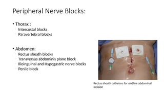 Acute and Chronic Pain Managsssement.pptx