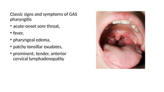 Acute and Chronic Pharyngitis-1.pptx surgical anatomy | PPTX