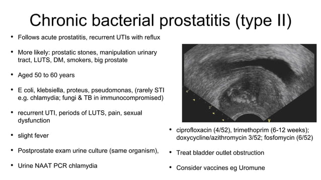 Acute and chronic prostatitis presentation IDF Malaga | PPT