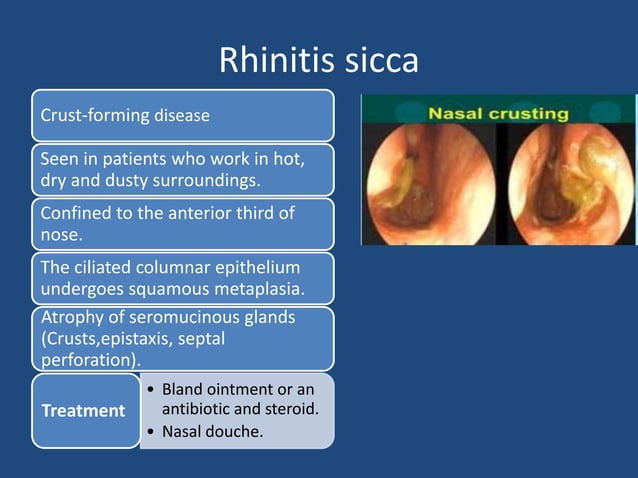 Acute and chronic rhinitis.pptx
