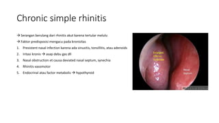 Acute and chronic rhinitis.pptx