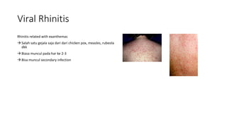 Acute and chronic rhinitis.pptx