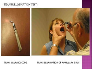 Acute and chronic sinusitis | PPTX