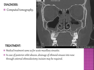Acute and chronic sinusitis | PPTX