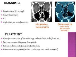 Acute and chronic sinusitis | PPTX