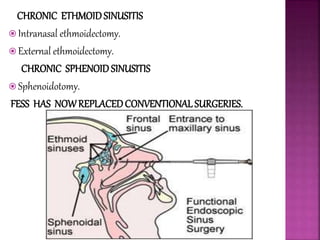 Acute and chronic sinusitis | PPTX
