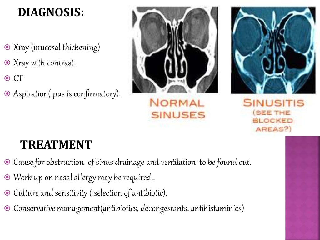 Acute and chronic sinusitis