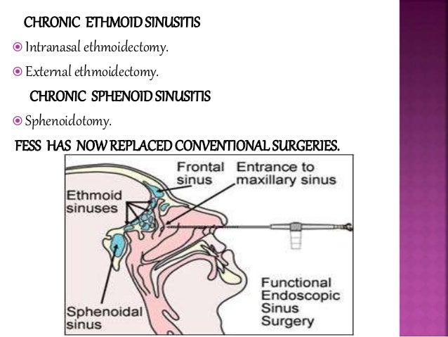 Acute and chronic sinusitis
