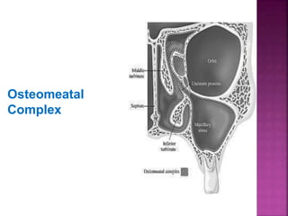 Acute and Chronic Sinusitis.pptx