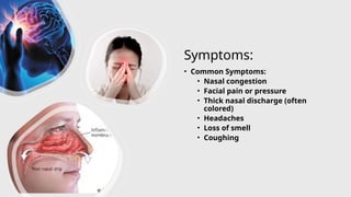 acute and chronic sinusitis haneen zayed | PPT