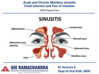 Acute and Chronic sinusitis, focal and foci of infection.pptx