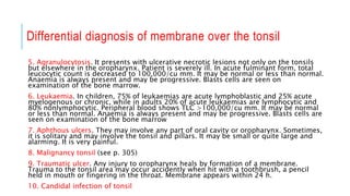 Acute and chronic tonsilitis | PPTX