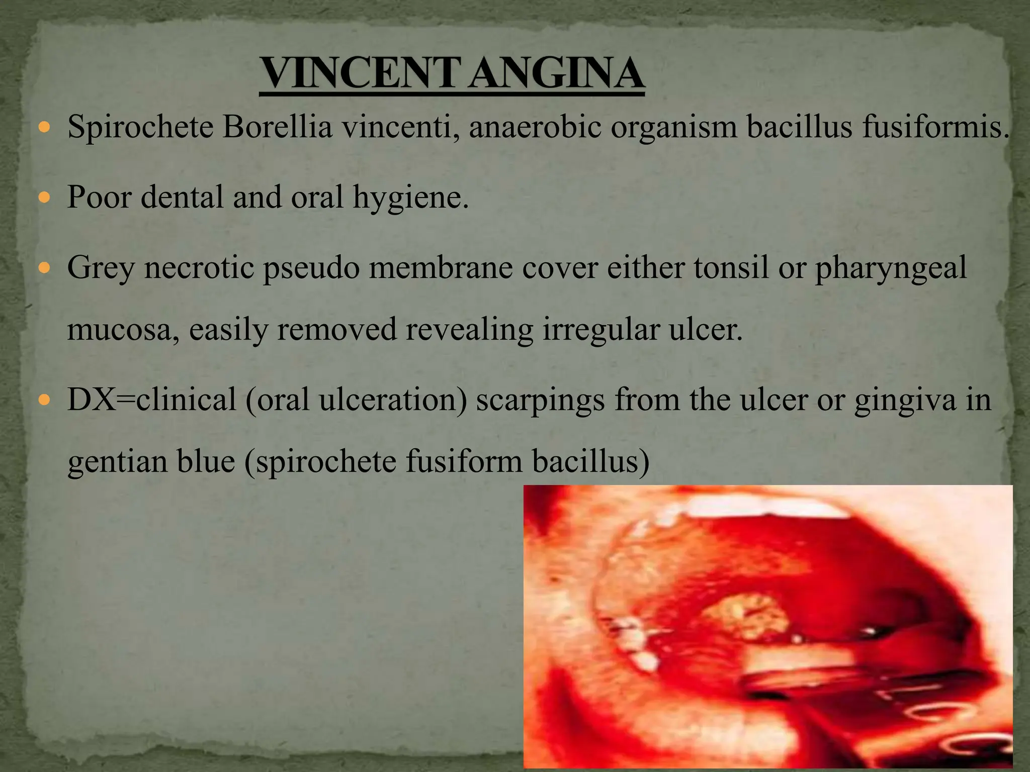 ACUTE AND CHRONIC TONSILITIS.pptx
