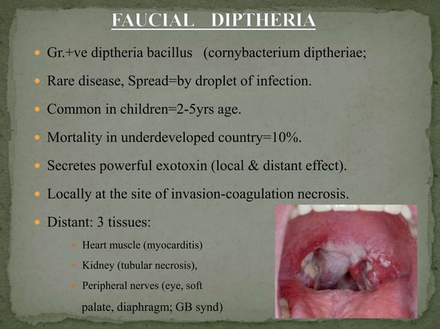 Acute And Chronic Tonsilitis Pptx
