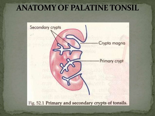Acute And Chronic Tonsilitis Pptx