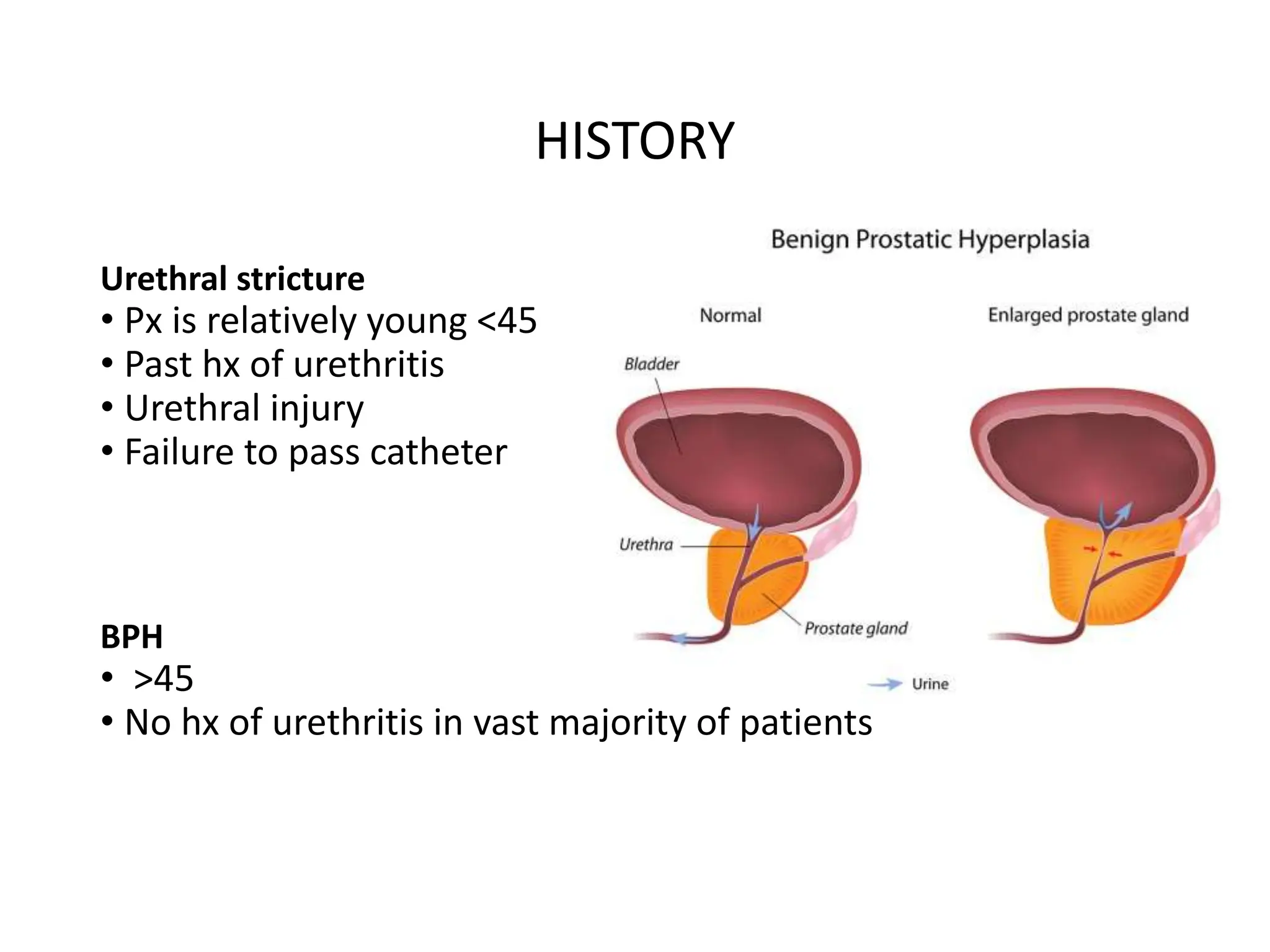 Acute and Chronic Urinary Retention.pptx