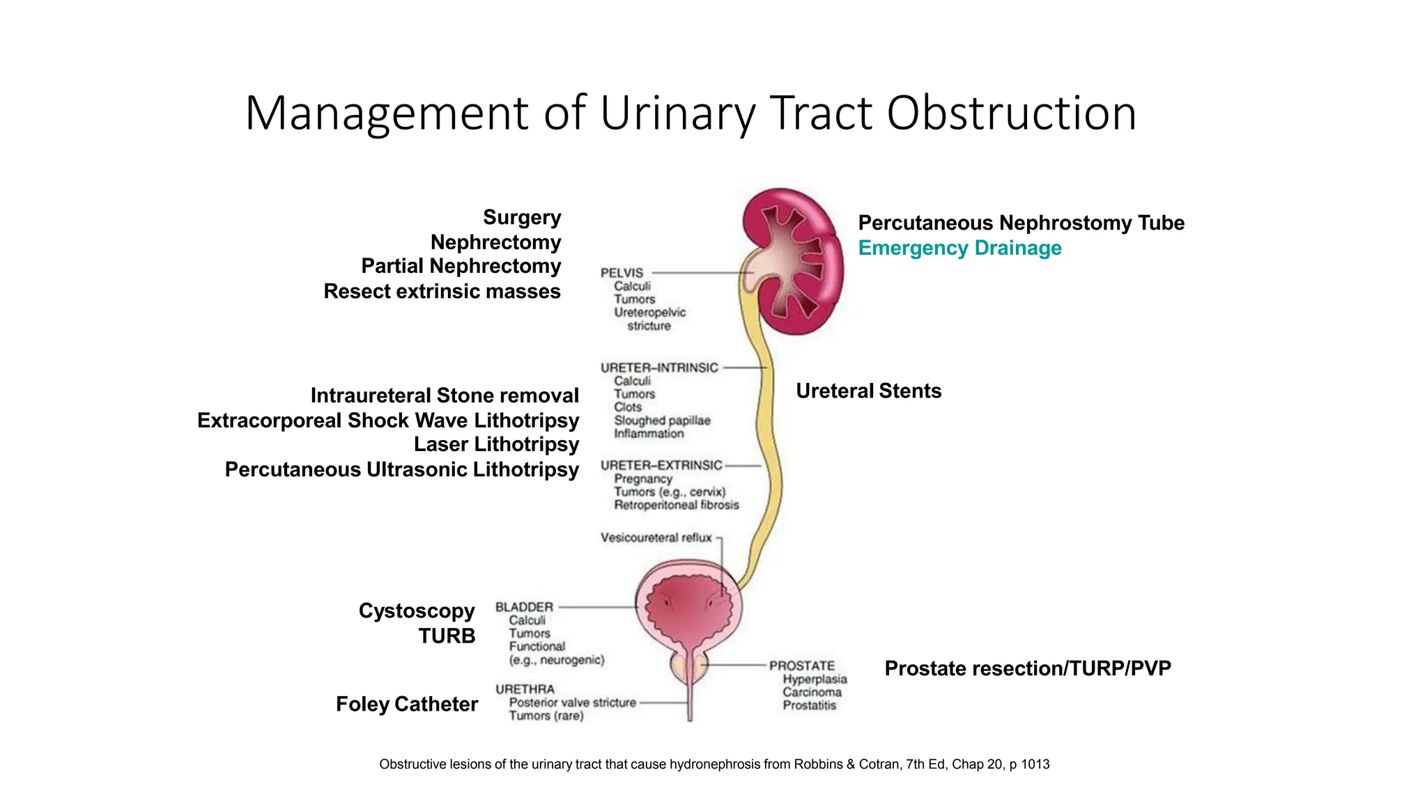 ACUTE AND CHRONIC URINARY RETENTION.pptx