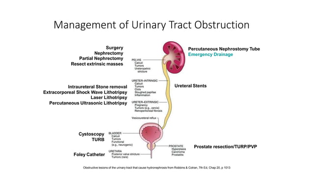 ACUTE AND CHRONIC URINARY RETENTION.pptx