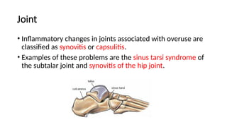 Acute and Overuse Injuries unlock.nnnpptx | PPTX