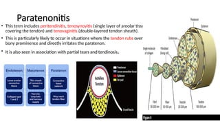Acute and Overuse Injuries unlock.nnnpptx | PPTX