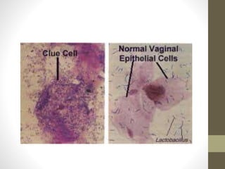 Acute and persistent vaginitis | PPT